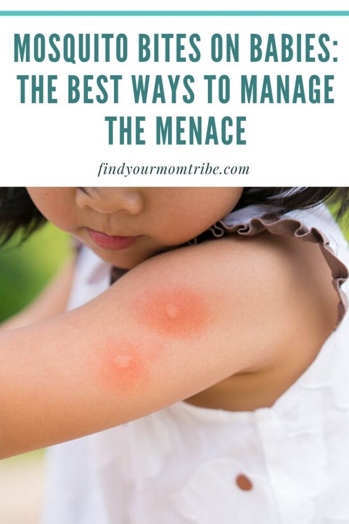 Mosquito Bites On Babies: The Best Ways To Manage The Menace