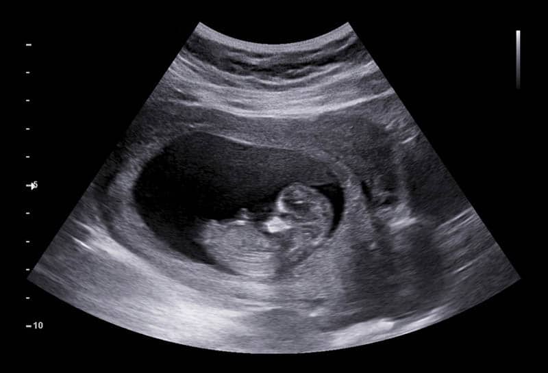 6 Things To Consider Before Getting A Private Ultrasound Scan 6 Things To Consider Before Getting A Private Ultrasound Scan