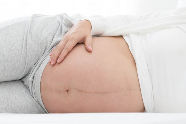 Linea Nigra - What It Is, Why It Happens And How Long It Lasts